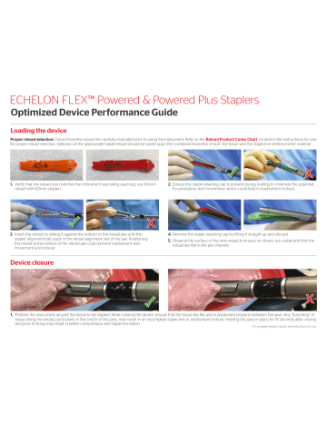 Ethicon ECHELON FLEX Instructions For Use | Manualzz