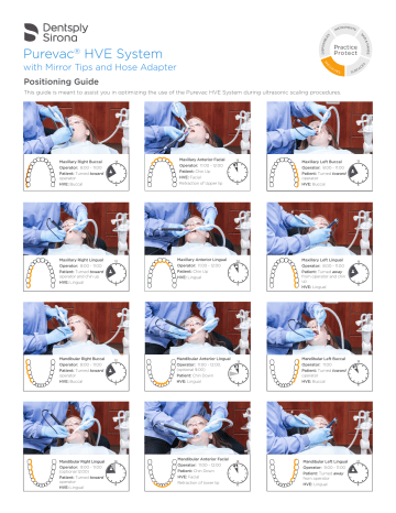 Dentsply Sirona Purevac HVE Positioning Manual | Manualzz
