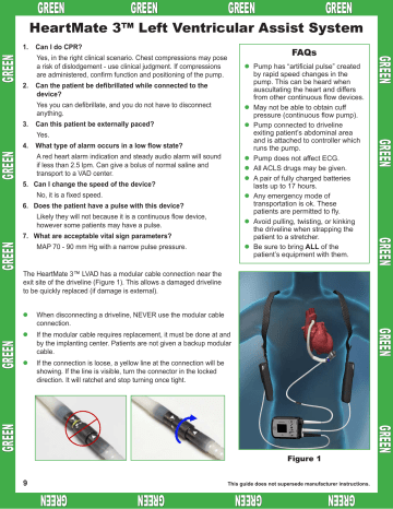 Abbott Heartmate 3 Quick Start Manual | Manualzz
